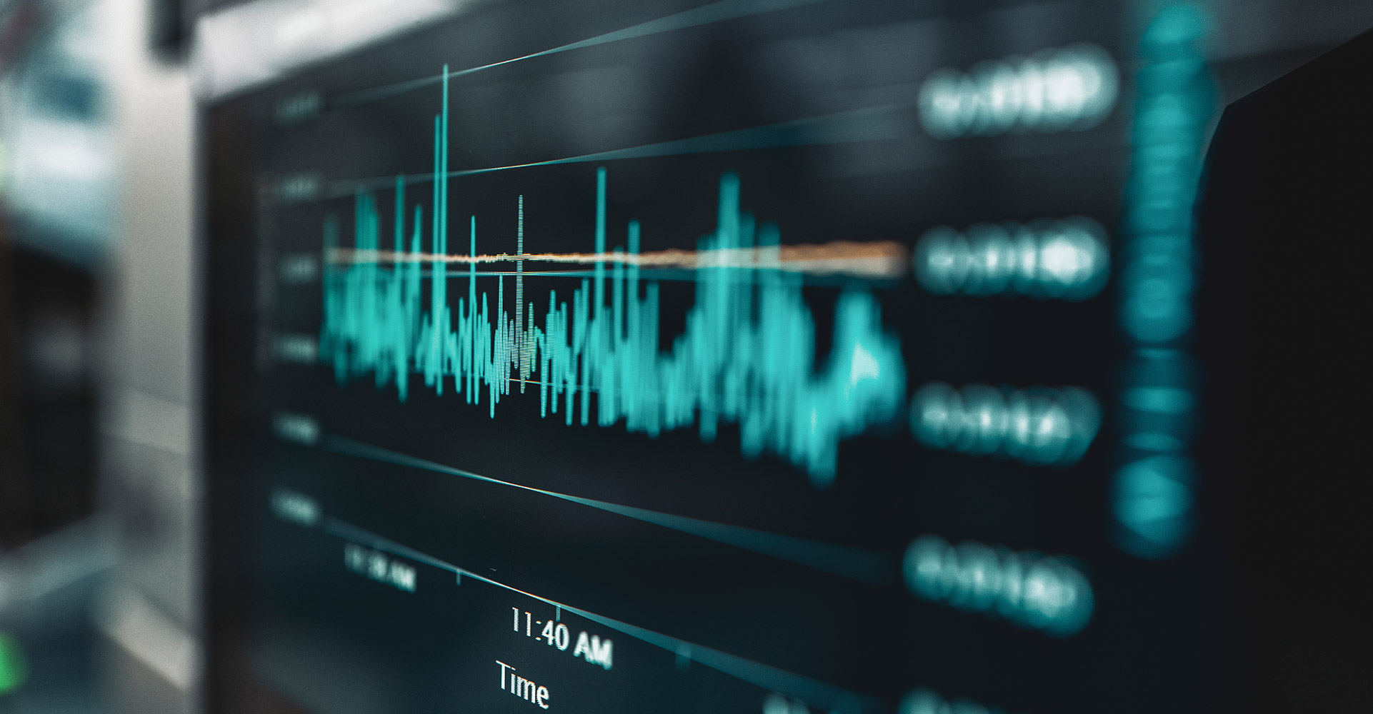 Cardiomyopathie hypertrophique