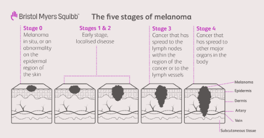 Melanoma skin cancer
