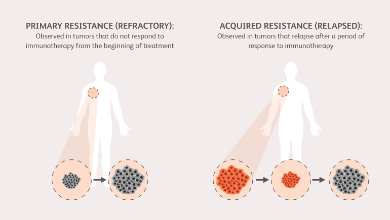 Understanding Immunotherapy Resistance: A Q&A with Dr. Jason Luke ...